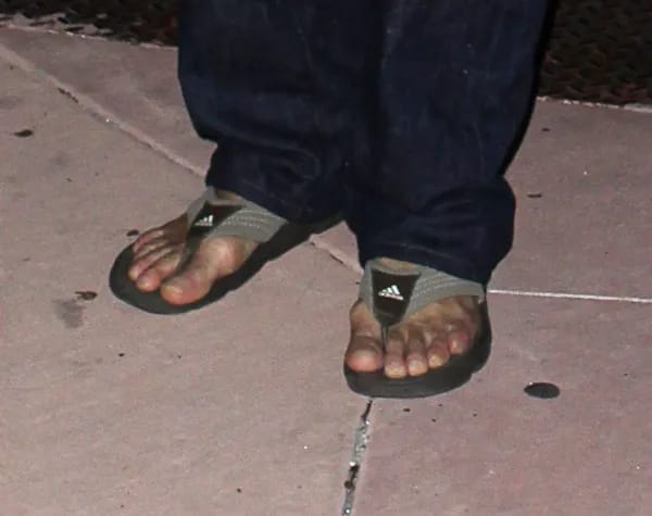 Celebrities With Bad Feet | Celebrities With Ugly Toes - SHEfinds