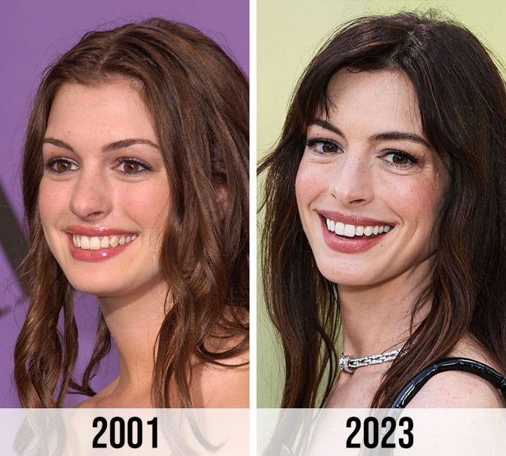 Anne Hathaway Pictures From 2001 Are Compared With Pictures From 2023 ...