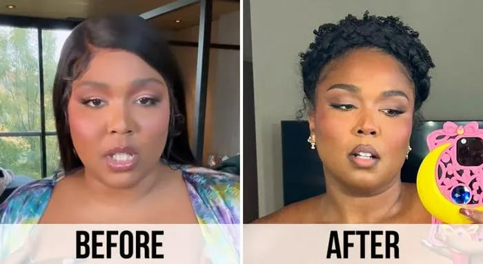 The Internet Thinks Lizzo Has The ‘Gaunt Ozempic Face’ After Losing A ...