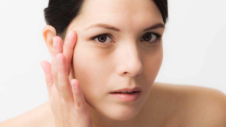 What Are Undereye Circles | How To Prevent Undereye Circles - SHEfinds