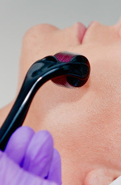 Derma-Rolling Can Give You Radiant, Healthy Skin (Without Pain) — Here ...