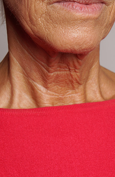 The Most Effective Ways To Keep Your Neck From Aging - SHEfinds