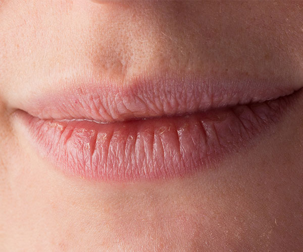 The Huge Mistake Women Make With Their Lips In Winter - SHEfinds