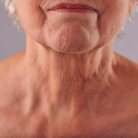 What Is Crepe Skin? Here’s Everything You Need To Know About Preventing ...