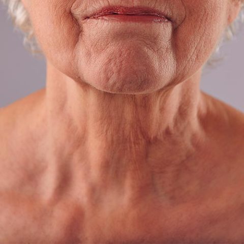 What Is Crepe Skin? Here’s Everything You Need To Know About Preventing ...