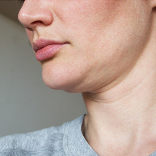 The One Supplement You Should Take Every Day To Erase Sagging Skin For ...