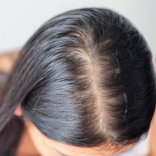 The One Shampoo You Need To Stop Using If Your Hair Keeps Breaking and ...