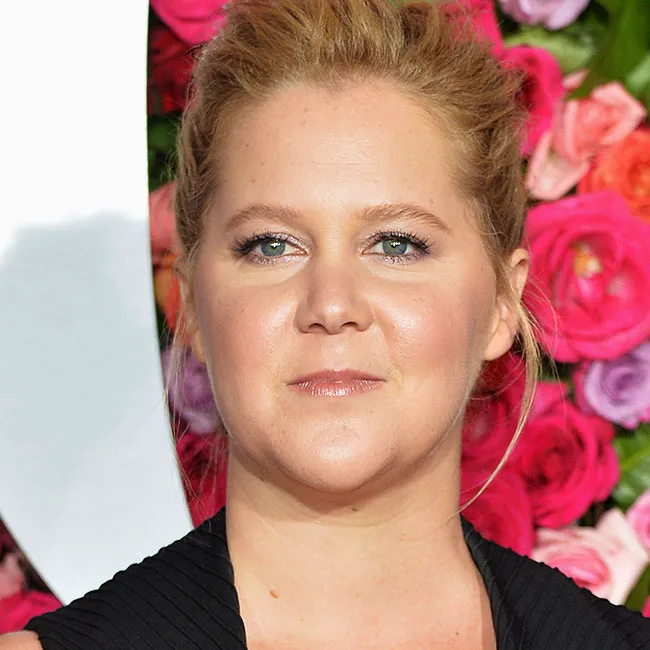 Amy Schumer Shares A Candid Post About Plastic Surgery—And Her Warning ...