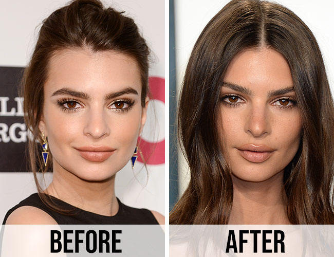 Emily Ratajkowski Doesn’t Even Look Like Herself Anymore—Her Face Has ...