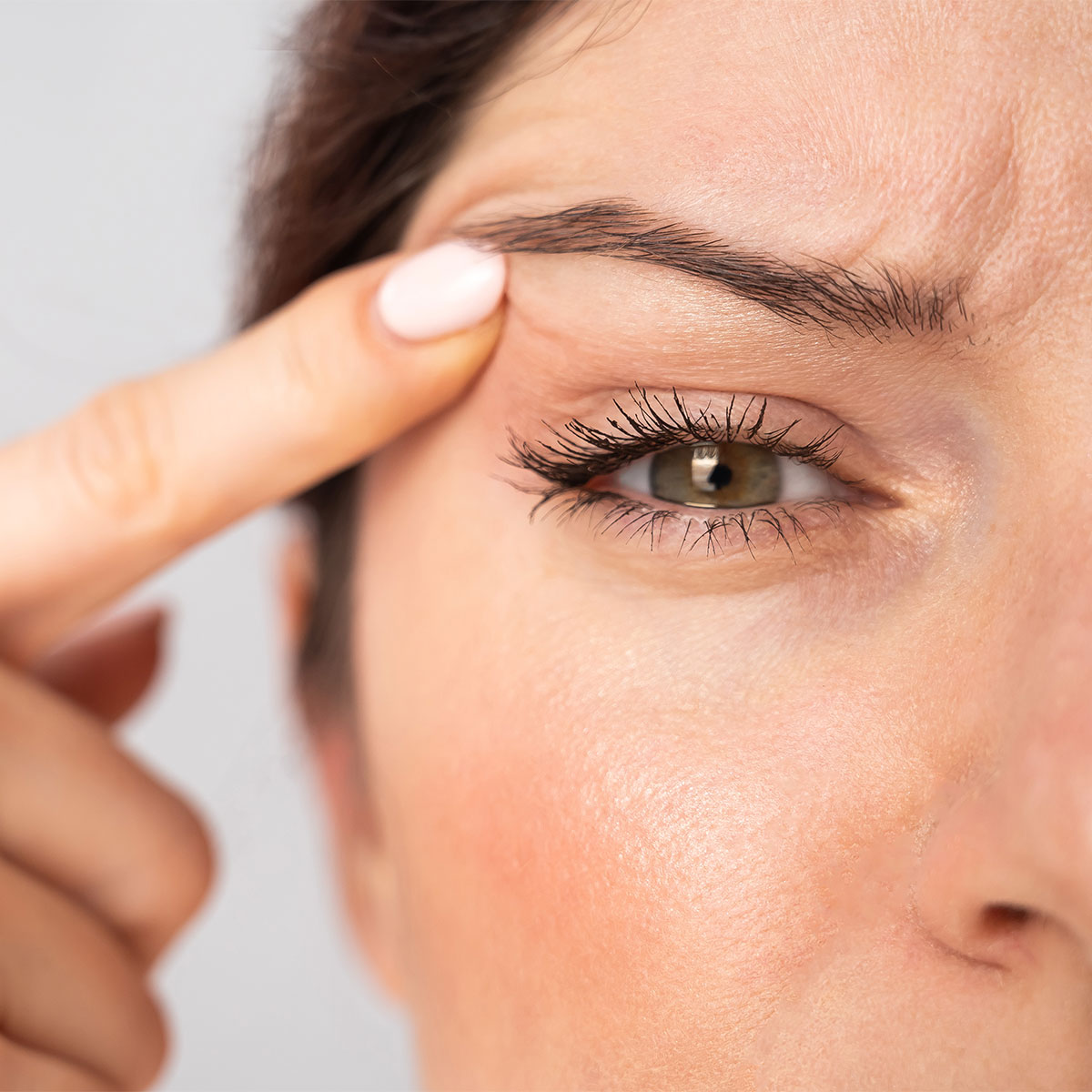 Furrowed Brow Wrinkles