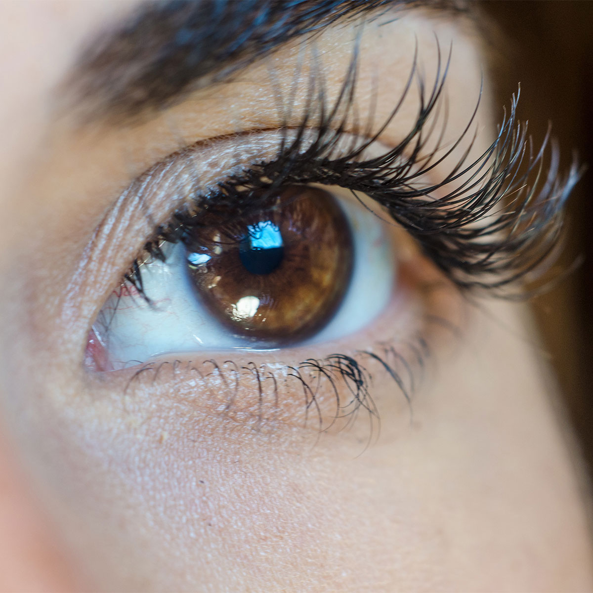 4 Anti-Inflammatory Foods You Should Eat For Sagging Skin On The Arms ...