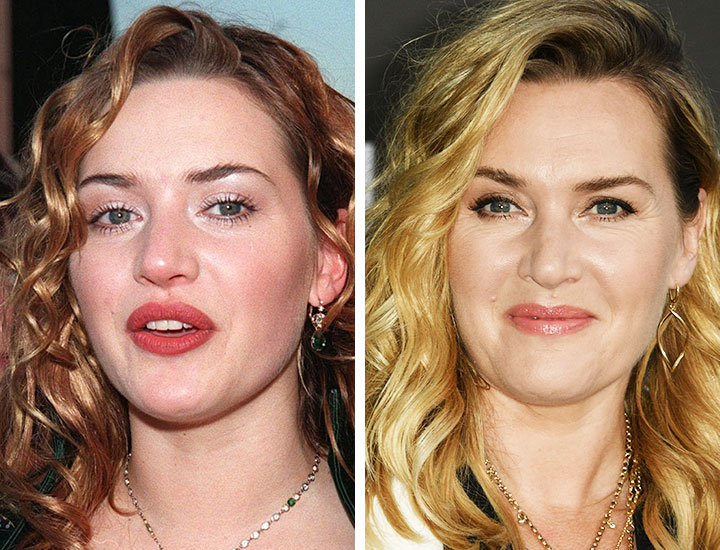 Celebrities Who Aged Well: Talk About Aging In Style - SHEfinds