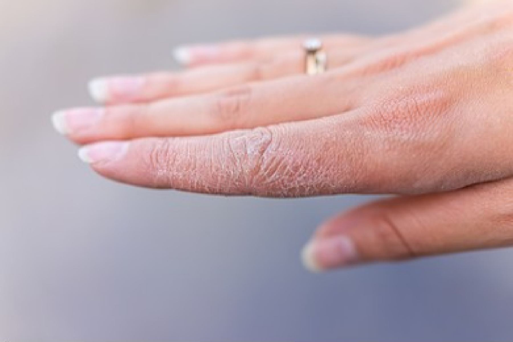 2 Expert-Approved Tips For Banishing Dry, Crackling Hands This Winter ...