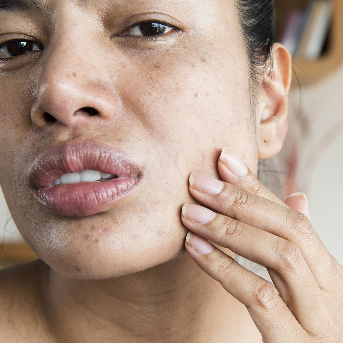 Spring Dry-Out Is A Real Thing For Skin, Experts Warn–Here’s How To ...