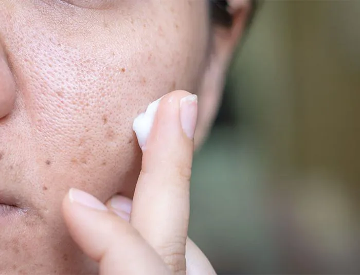 3 Popular Anti-Aging Ingredients Doctors Want You To Know Might ...