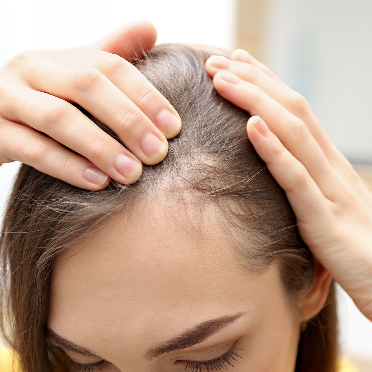 Experts Reveal The Surprising Reason Your Hair Is Falling Out—And How ...