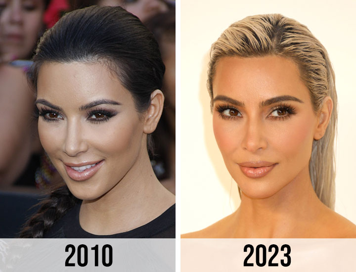 Fans Are Stunned After Seeing These Before And After ‘Plastic Surgery ...