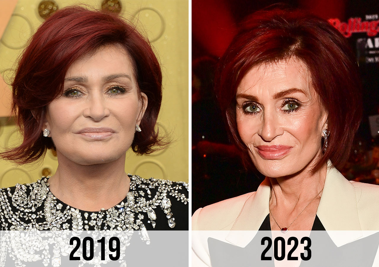 Sharon Osbourne, 71, Reveals That Getting A Facelift Was ‘The Worst ...