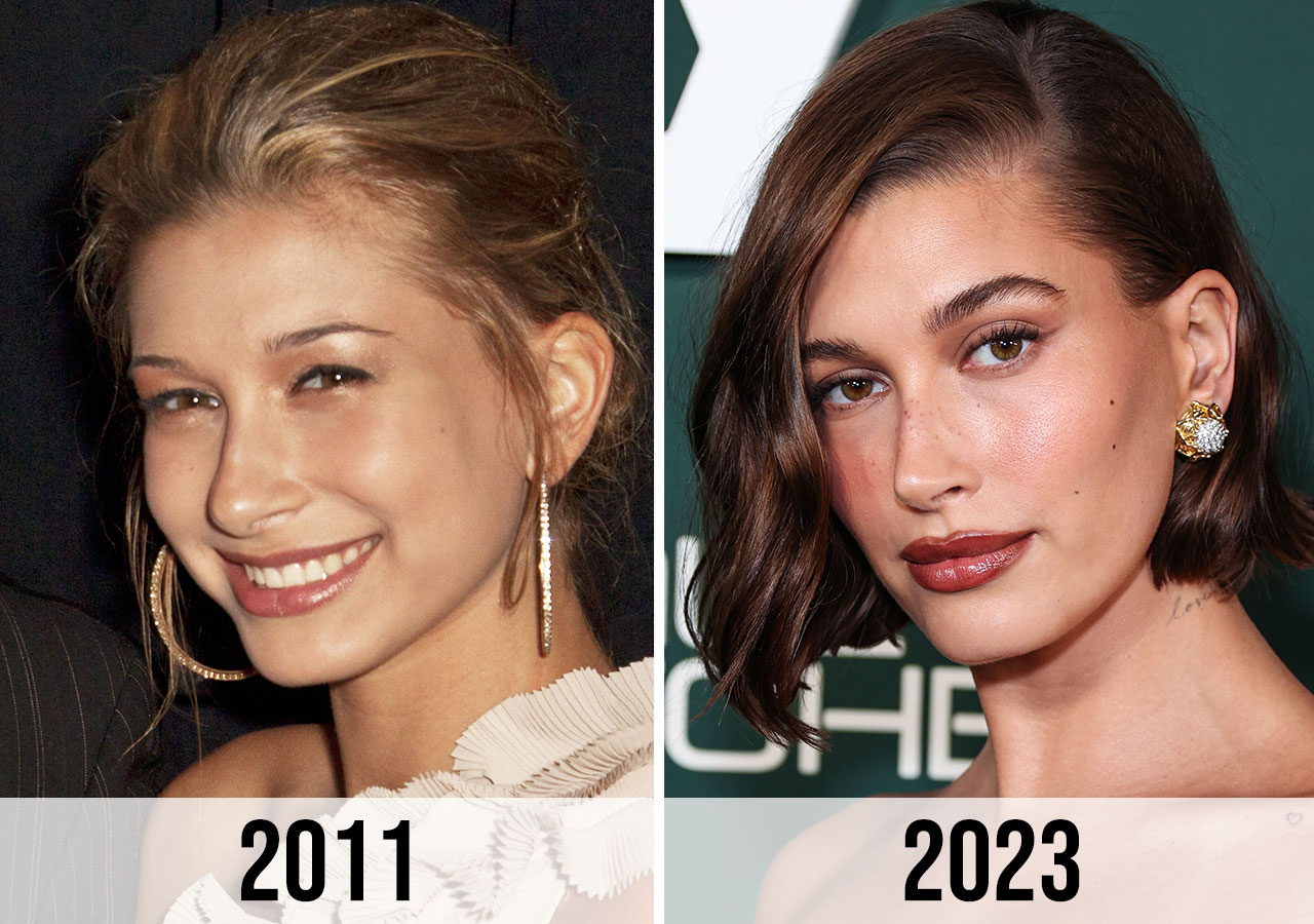 Fans React To Hailey Bieber’s Before & After Photos After Plastic ... Fans React To Hailey Bieber’s Before & After Photos After Plastic ...