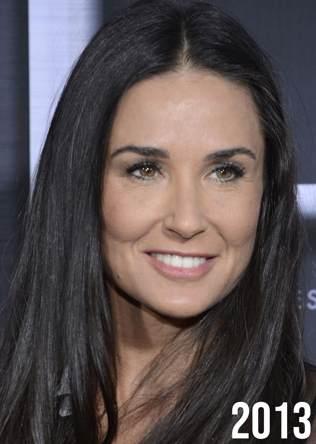 A Plastic Surgeon Breaks Down Demi Moore’s ‘New Face’ And Analyzes Her ...