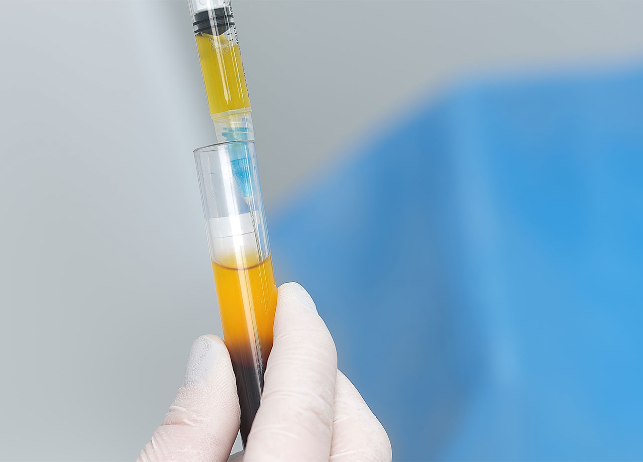 Derms Share The Most Effective Wrinkle-Reducing Treatments For A ...