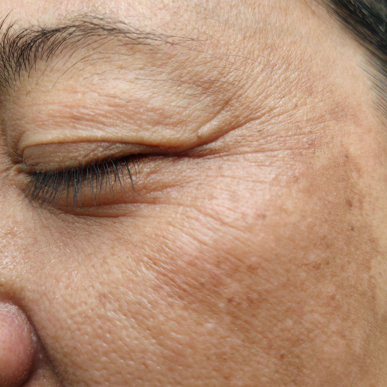 6 Best Anti-Aging Vitamins & Minerals Health Experts Recommend For Dry ...