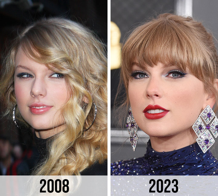 Good Genes Or Good Docs? Before And After Photos Of Taylor Swift’s Face ...