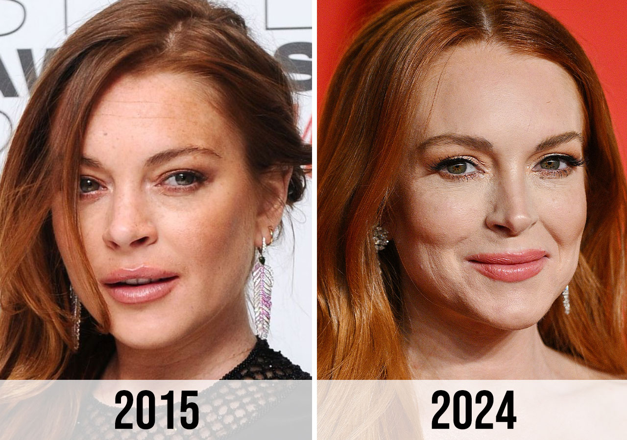 Lindsay Lohan Goes Makeup-Free In New Photo With Dermatologist As Fans Accuse Her Of Using ...