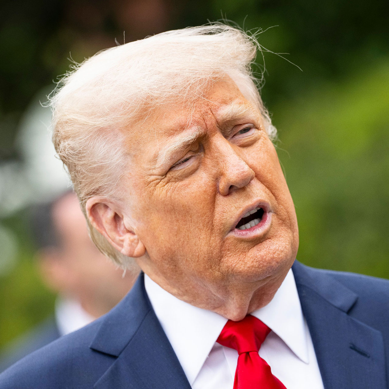 Has Ivanka Trump Gone Too Far With Plastic Surgery? Experts Reveal The ...