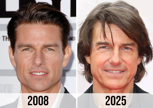 Doctor Breaks Down Tom Cruise’s Facial Transformation - SHEfinds