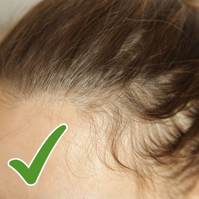 A Doctor Explains What Happens To Thinning, Damaged Hair After Using ...