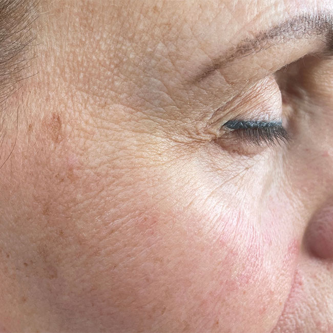 11 Acrylic Nail Shapes: Your Ultimate Guide To Nailing The Shape - SHEfinds